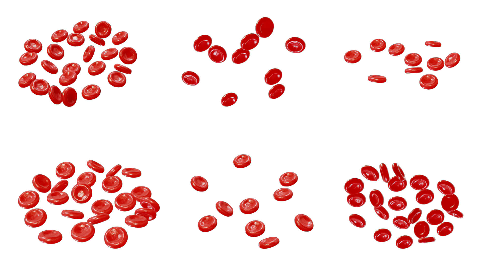 Normal Blood Cells Vs Anemia - 3D Model by h3ydari96