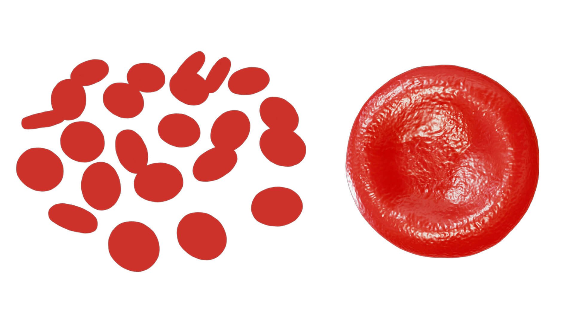 Normal Blood Cells Vs Anemia - 3D Model by h3ydari96