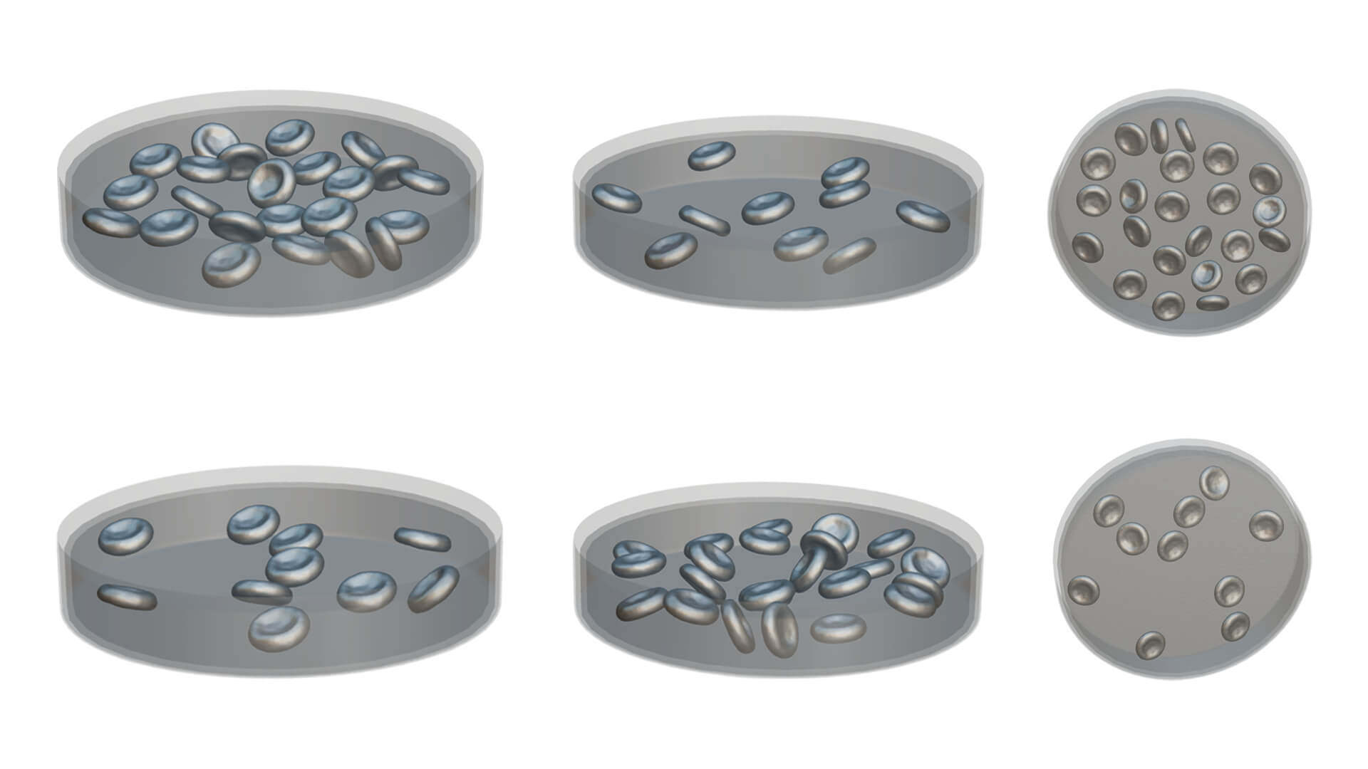 Normal Blood Cells Vs Anemia - 3D Model by h3ydari96