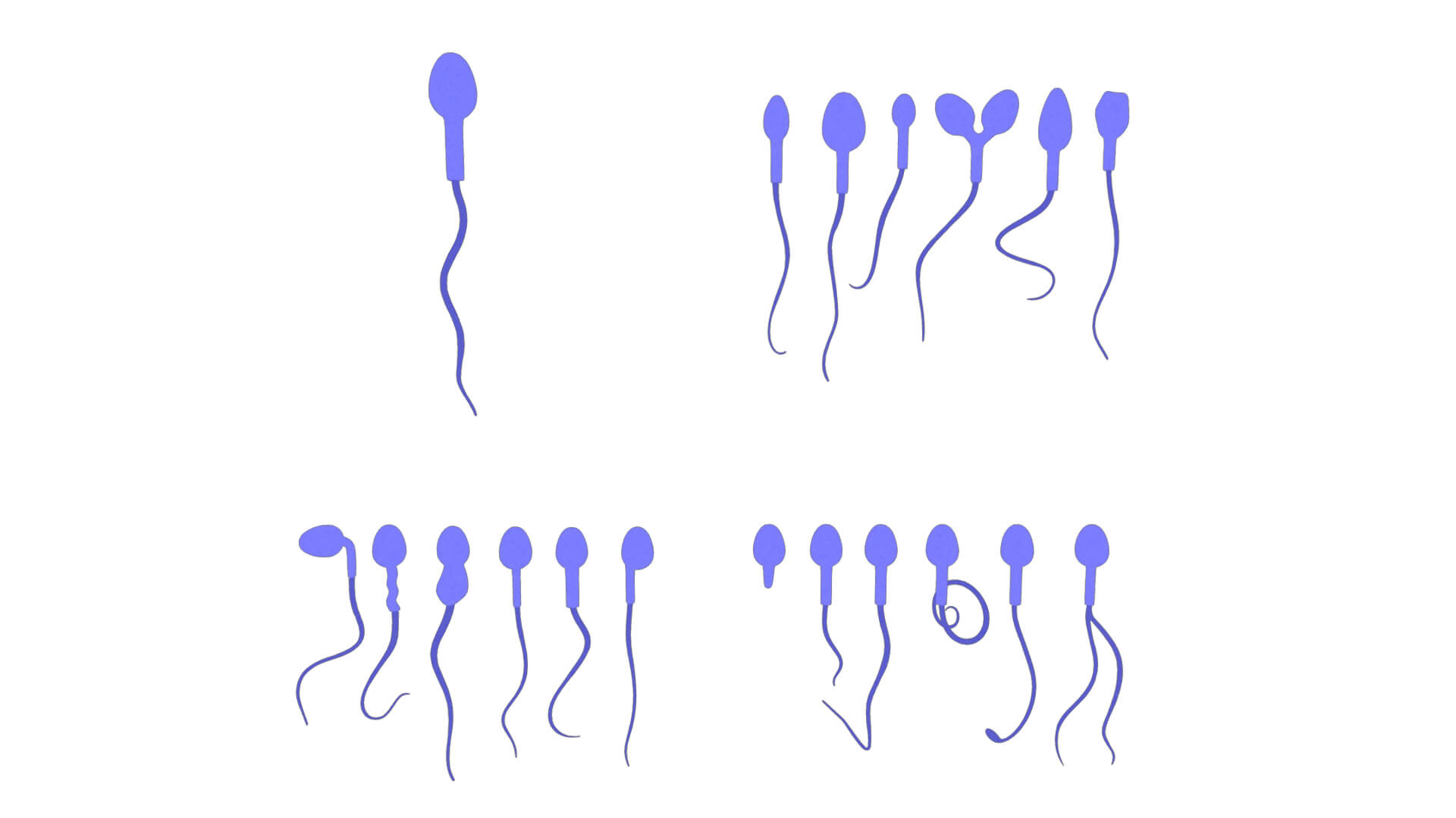 Sperm Morphology: Normal and Abnormal - 3D Model by h3ydari96