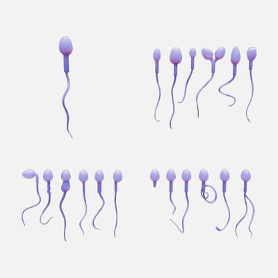 Sperm Morphology: Normal and Abnormal - 3D Model by h3ydari96