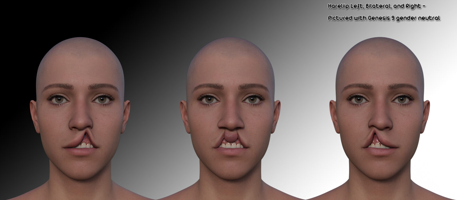 Harelip Morphs for Genesis 9 - Daz Content by Henrika