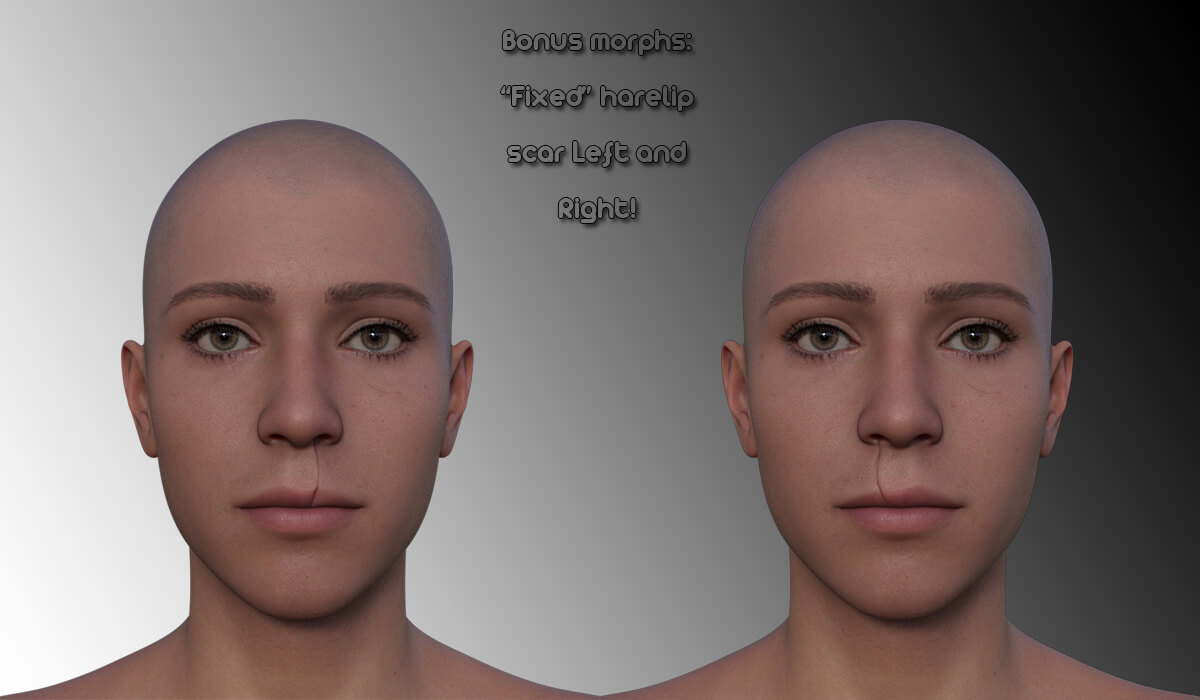 Harelip Morphs for Genesis 9 - Daz Content by Henrika