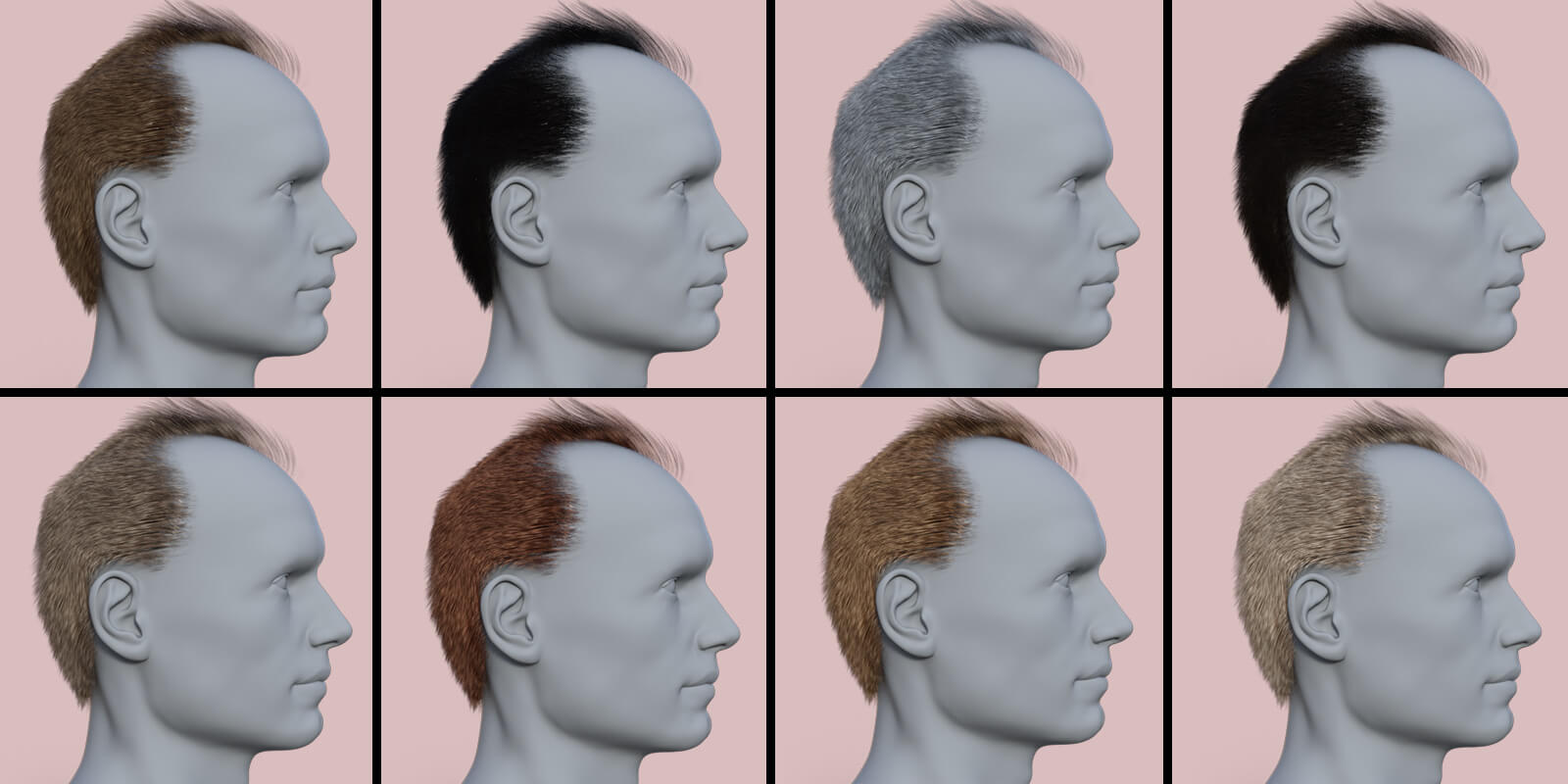 Receding Hair for G8, 8.1 and G9 Males - Daz Content by Henrika