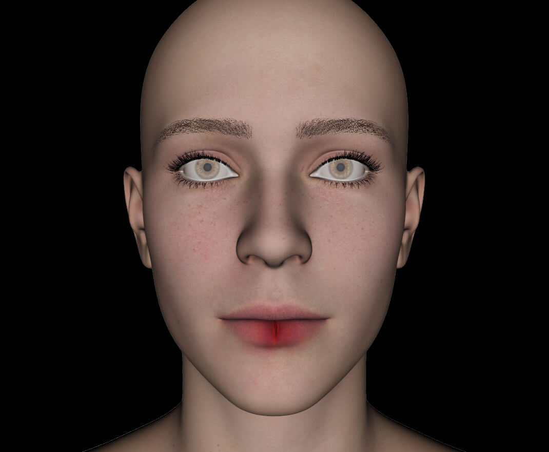 Cuts and Bruises Mega Set for Genesis 9 - Daz Content by janey