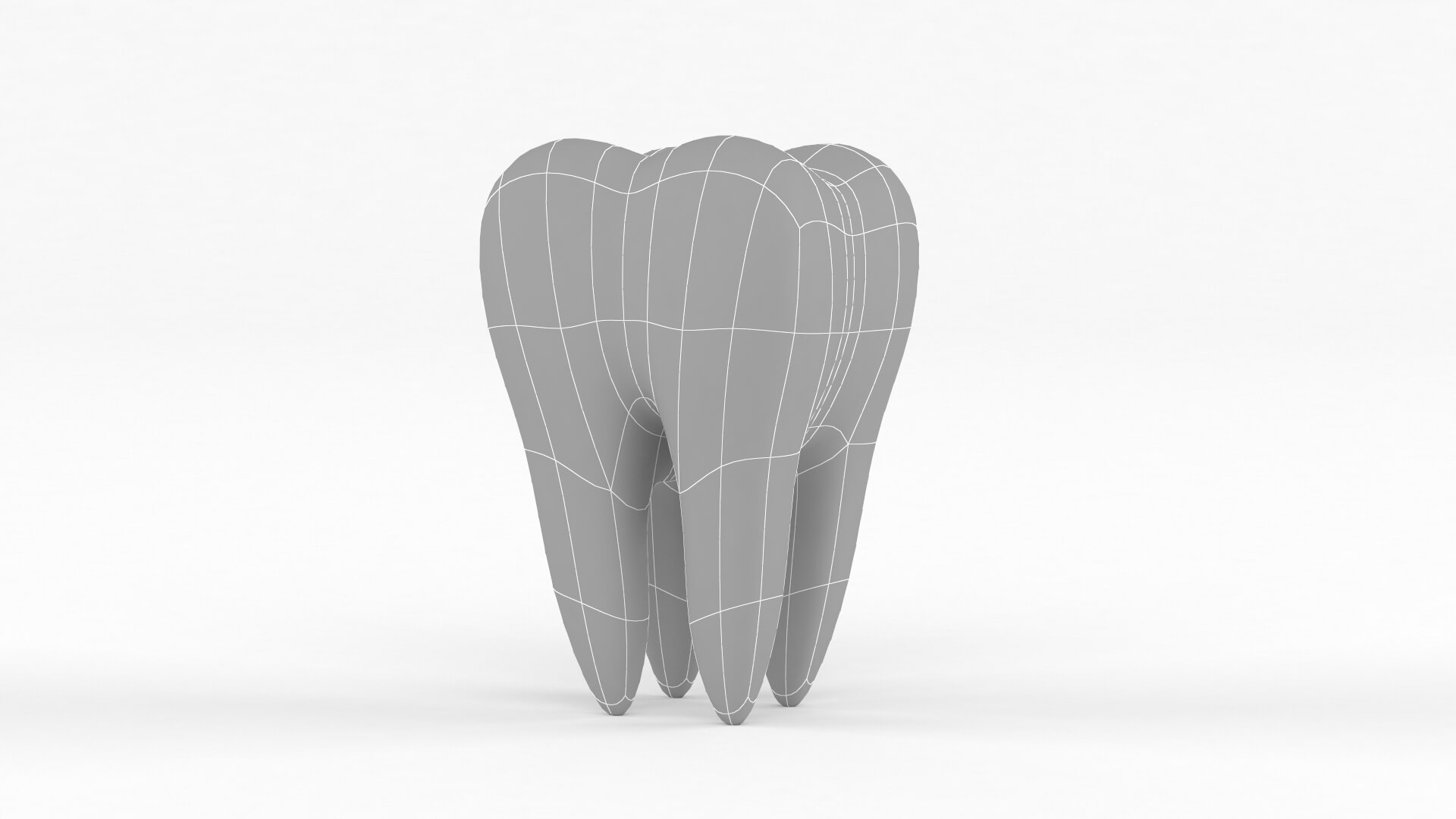 Tooth Implants - 3D Model by Javidan