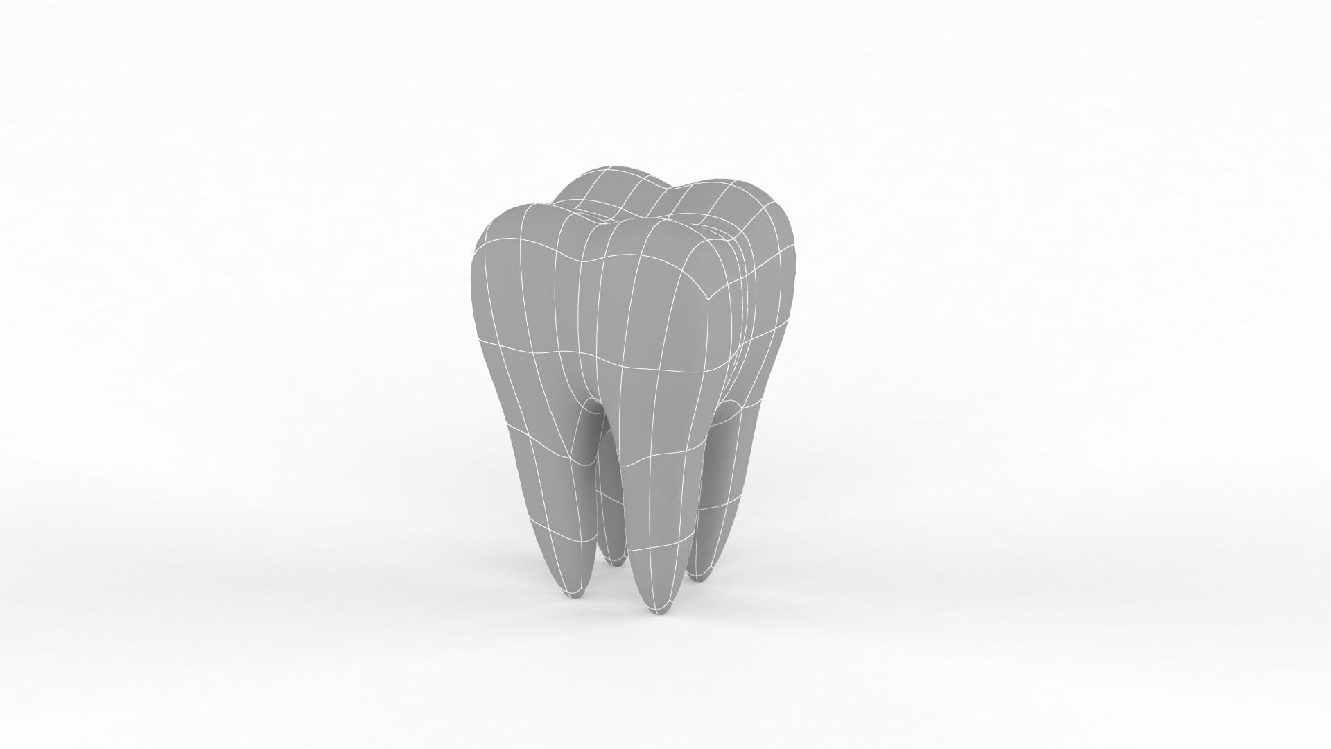 Tooth Implants - 3D Model by Javidan