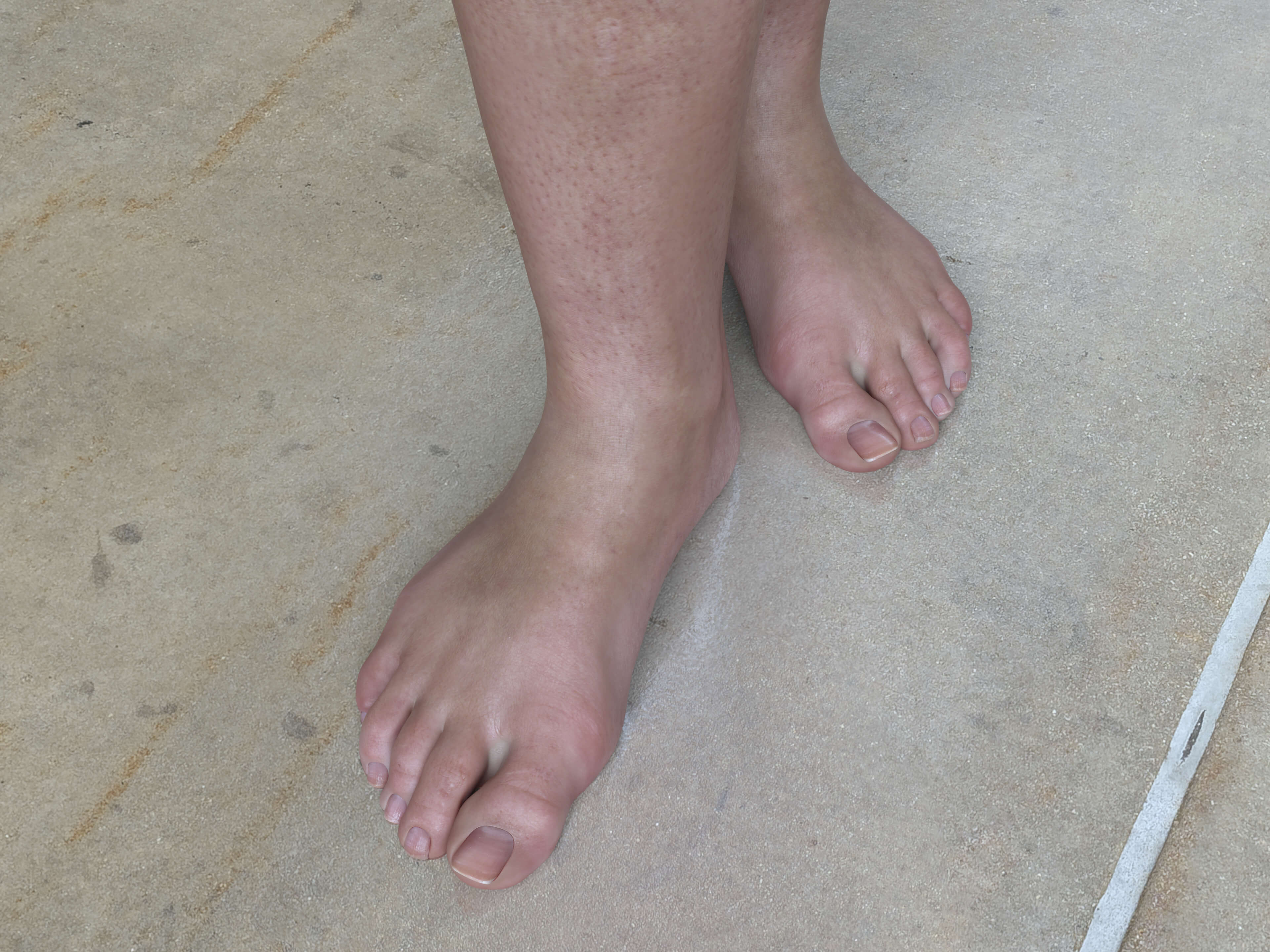 MP Realistic Feet for Genesis 8 and 8.1 Female - Daz Content by Metaphoral