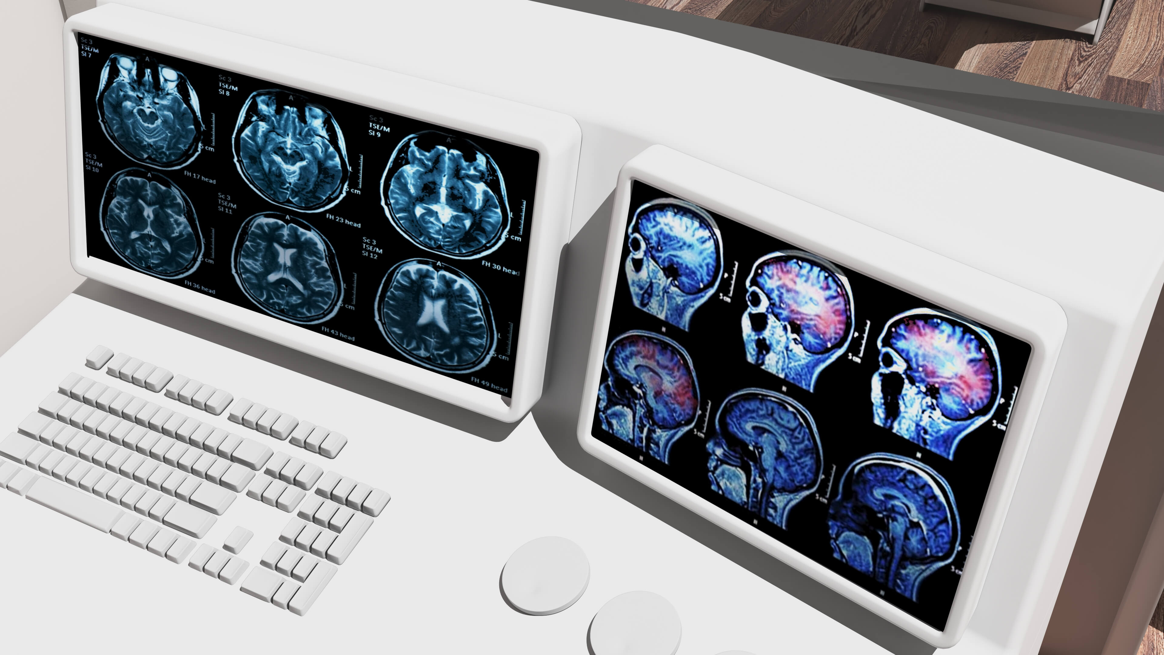 CT Scan - 4K 3D Model by Pictorer