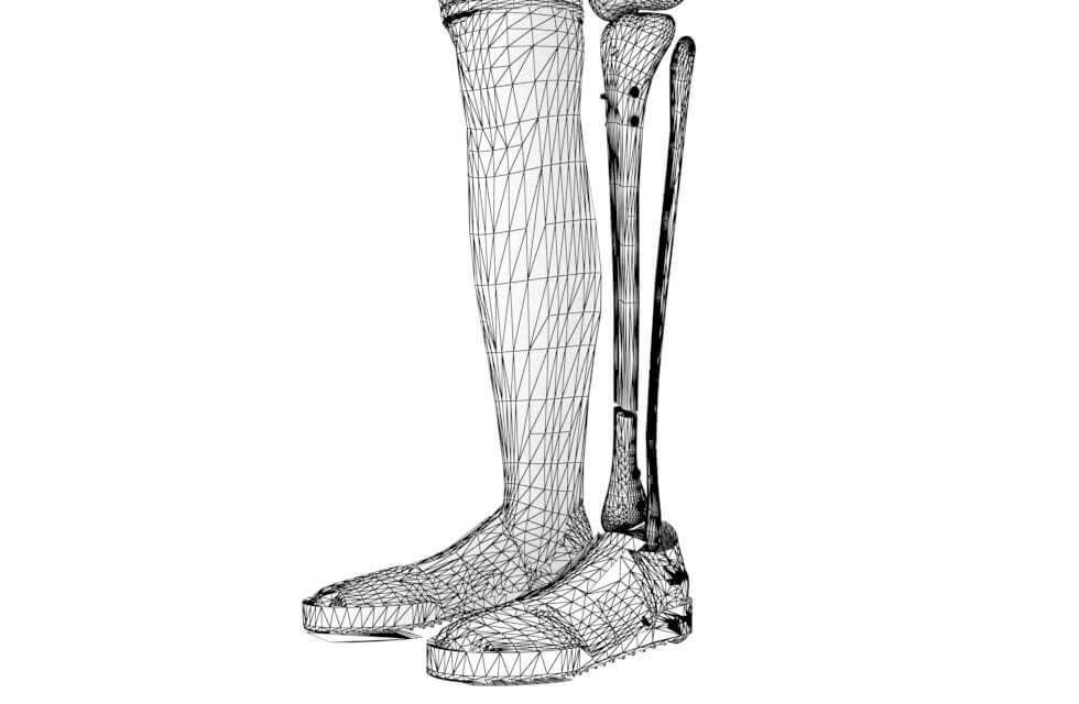 Tibial Intramedullary Nail - 3D Model by Pictorer