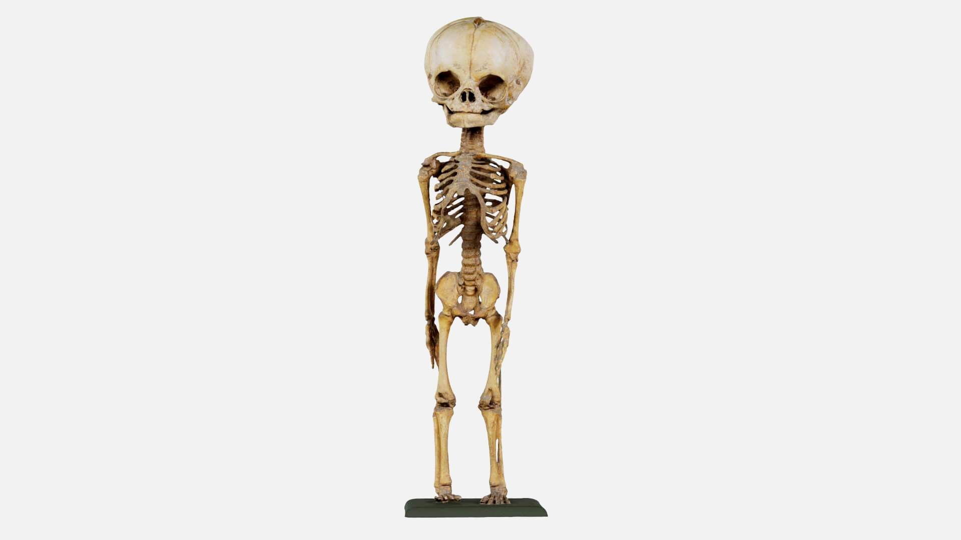 Unborn Human Baby Skeleton - 3D Model by Polygonal Miniatures