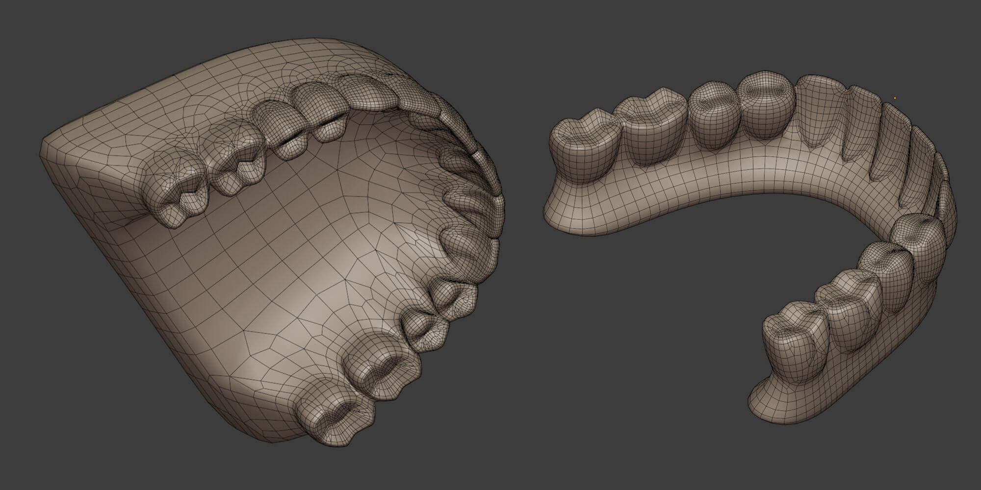 Dental Prosthesis - 3D Model by rossty3d