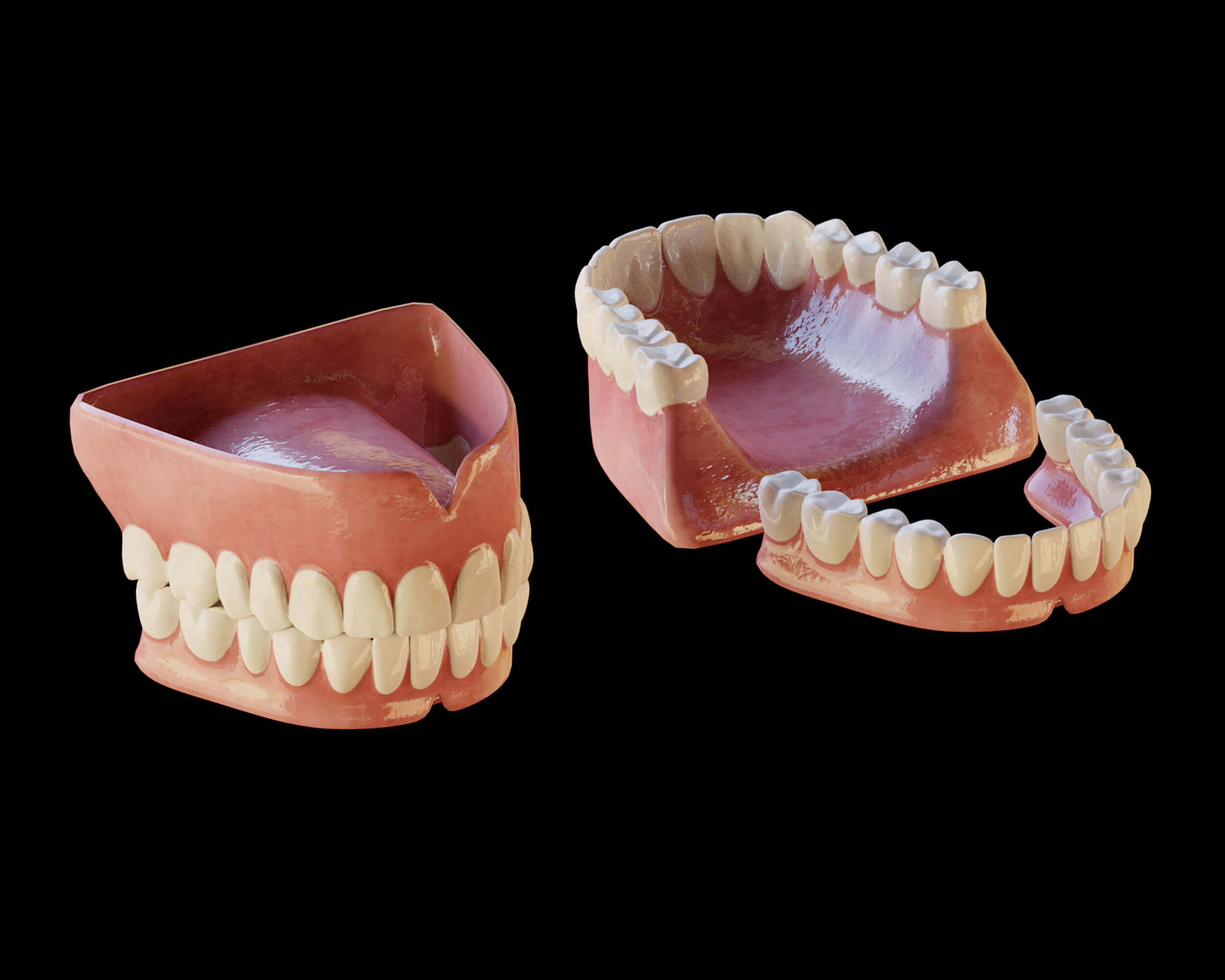 Human Teeth Prosthesis - 3D Model by rossty3d
