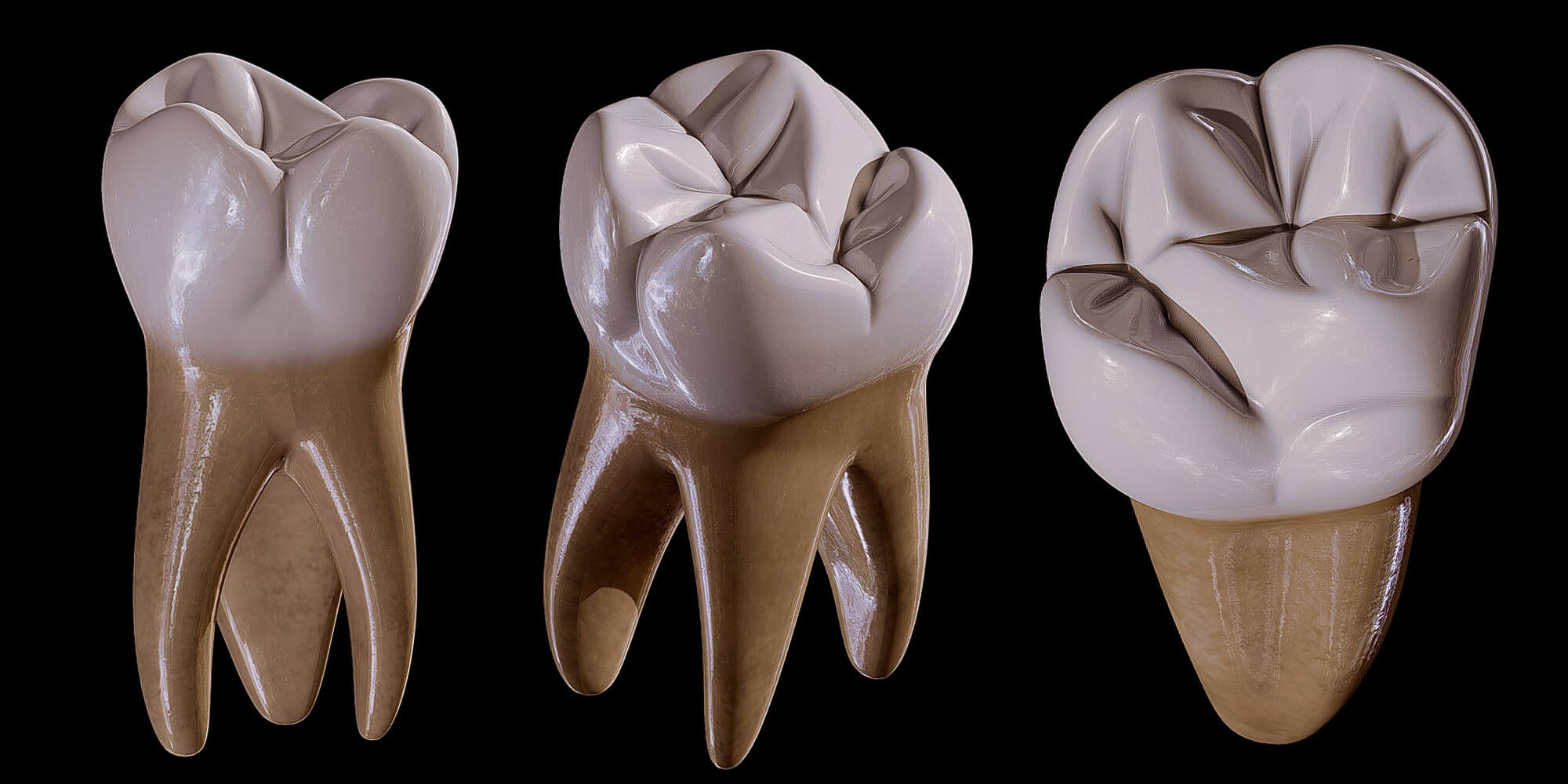 Human Tooth - First Upper Molar 3D Model by rossty3d