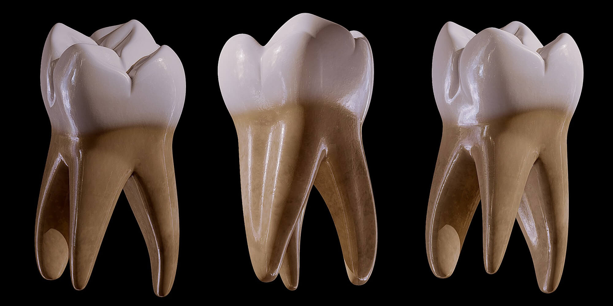 Human Tooth - First Upper Molar 3D Model by rossty3d