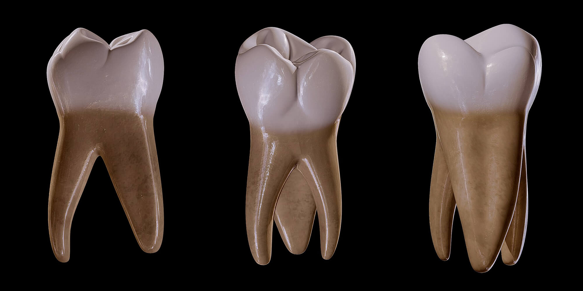 Human Tooth - First Upper Molar 3D Model by rossty3d