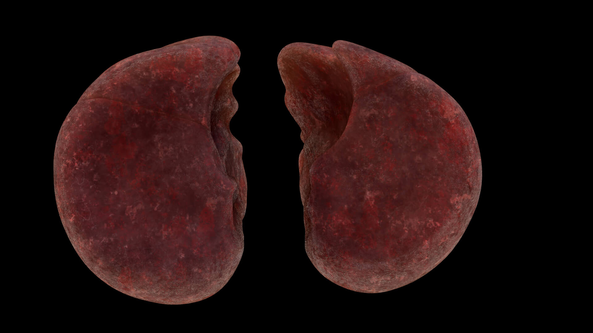 Smoker Human Lungs - 3D Model by ryro_animation