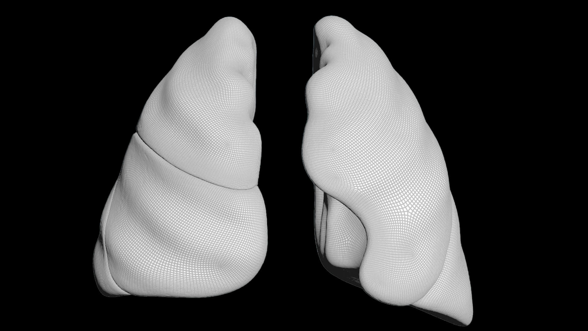 Smoker Human Lungs - 3D Model by ryro_animation
