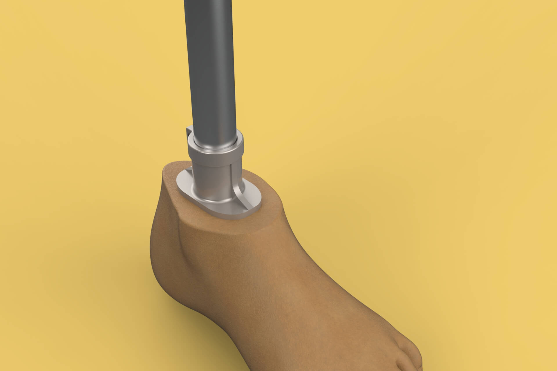 Medical Artificial Prosthetic Leg Mechanical Four Bar Joint - 3D Model ...