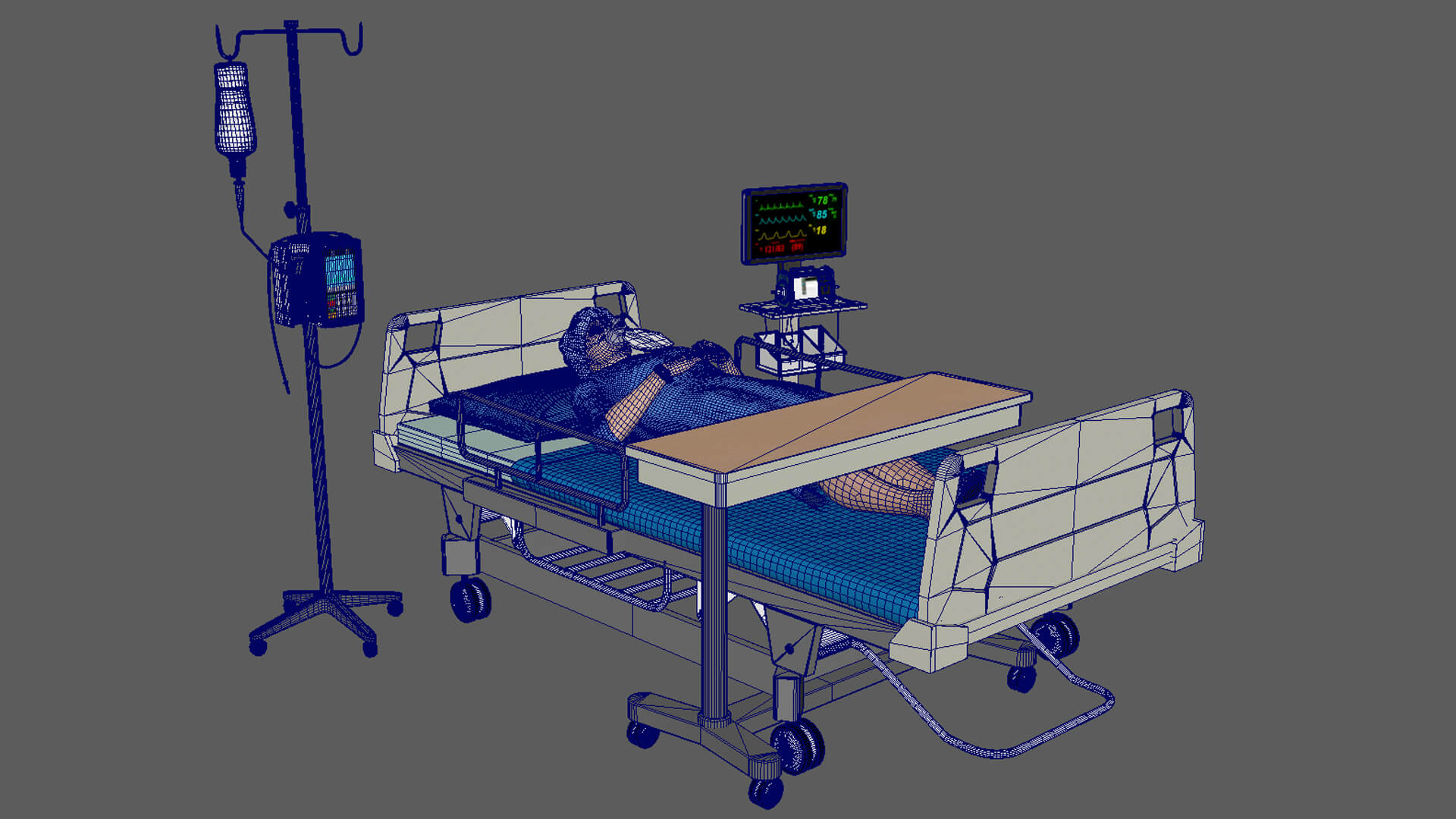 Patient in Bed - Blue Gown 3D Model by Trish