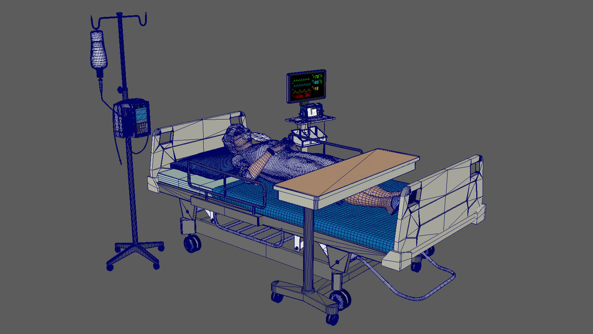 Patient in Bed - White Gown 3D Model by Trish