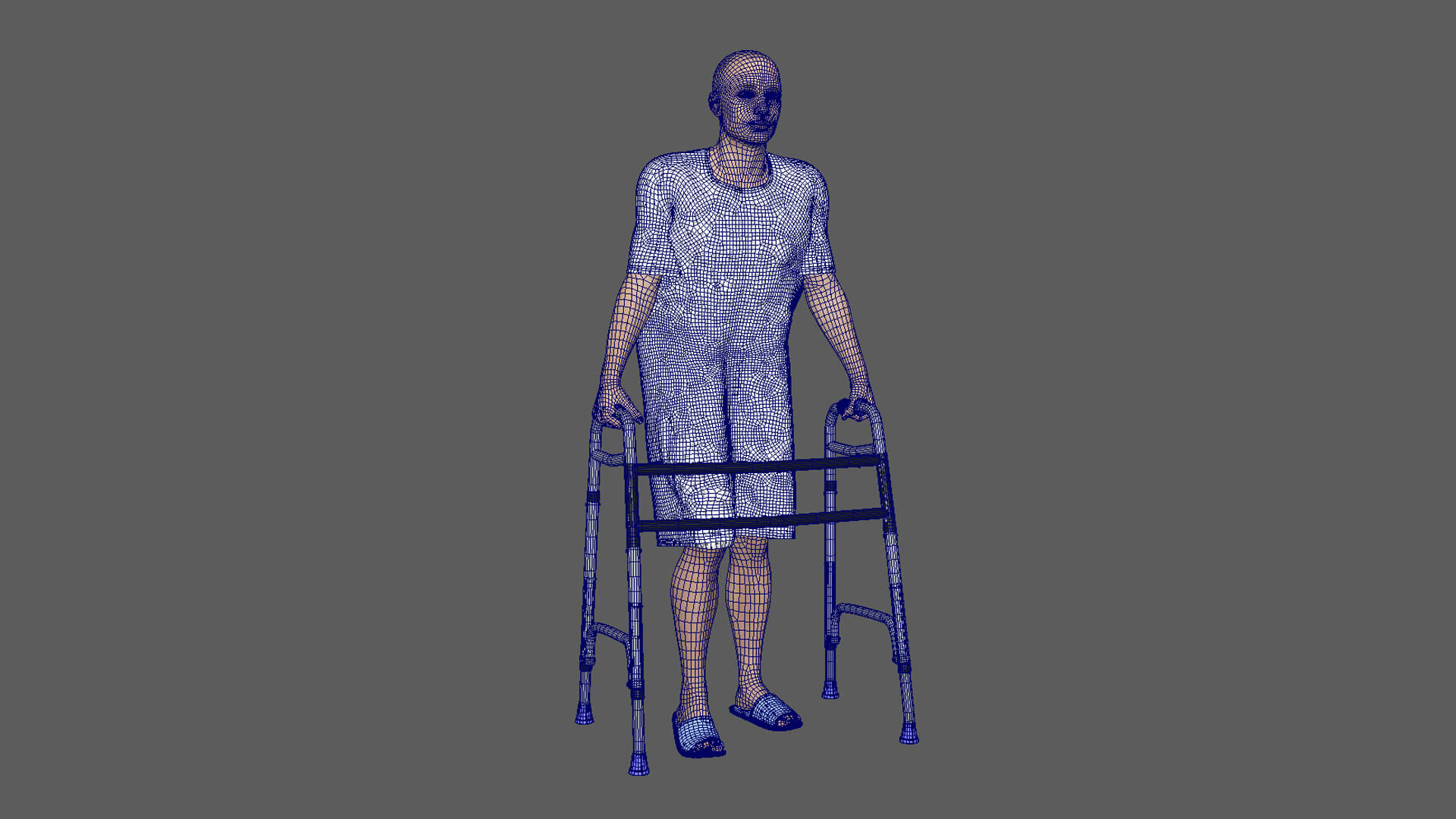 Patient With Walker - 3D Model by Trish