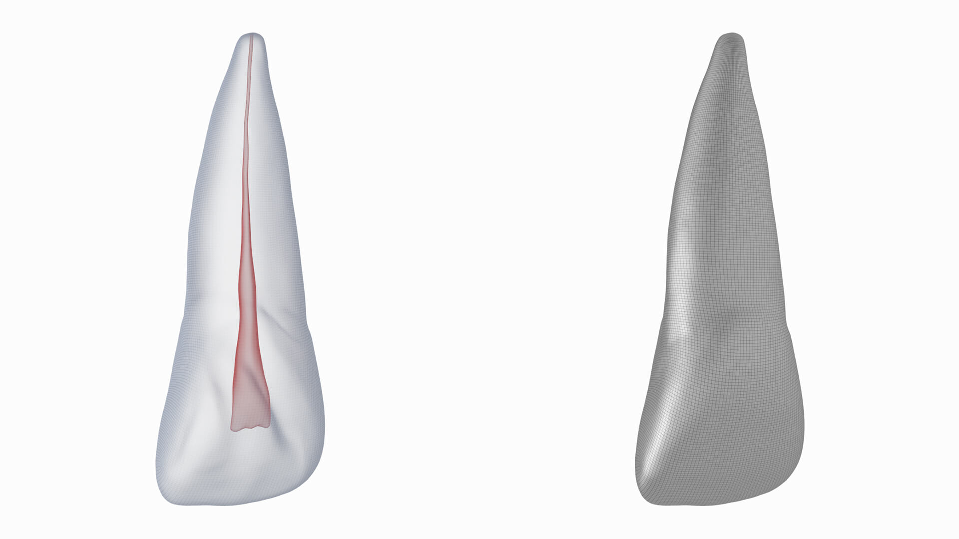 Human Upper Left Central Incisor Tooth With Pulp Cavity - 3D Model by ...