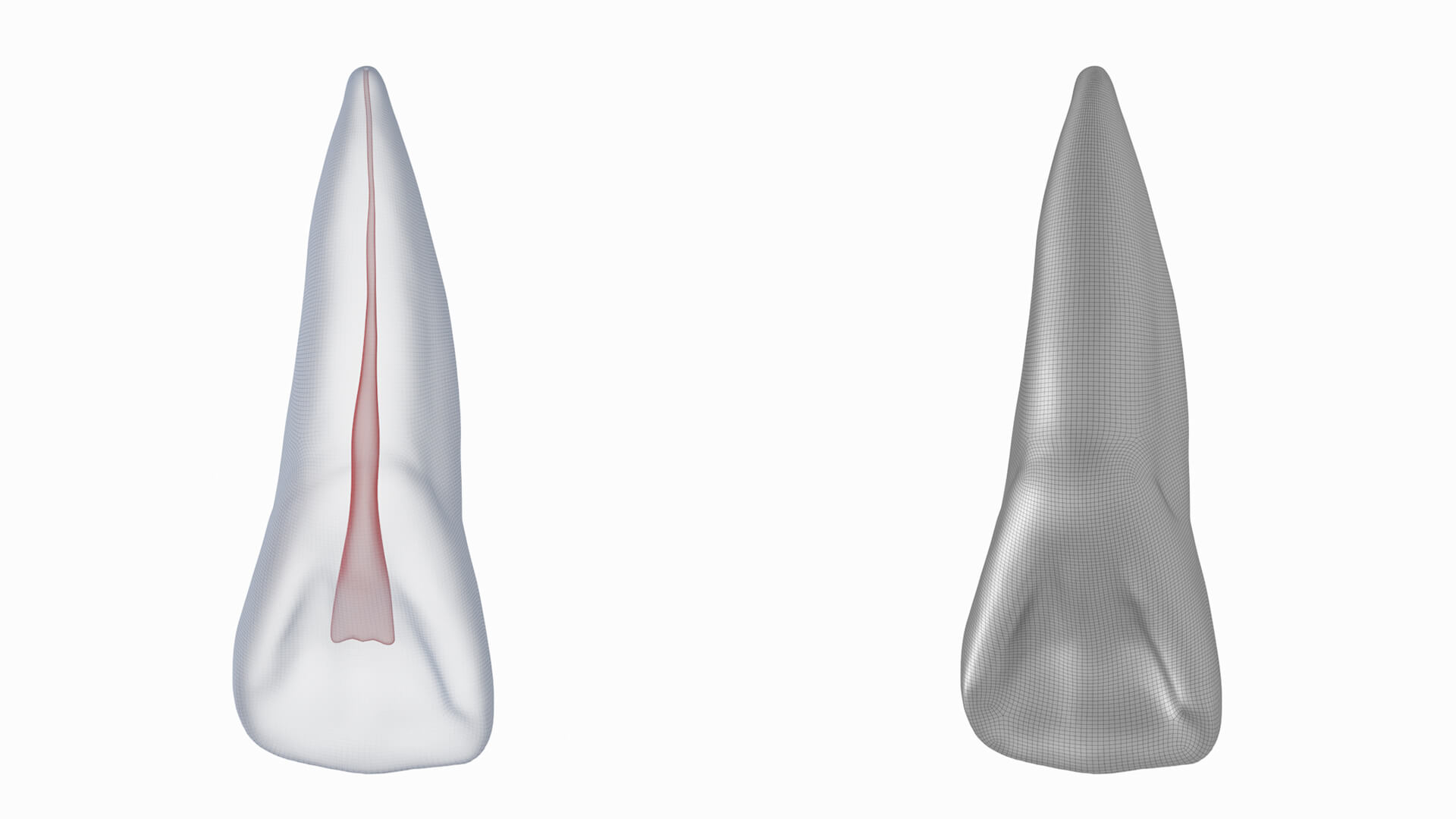 Human Upper Left Central Incisor Tooth With Pulp Cavity - 3D Model by ...