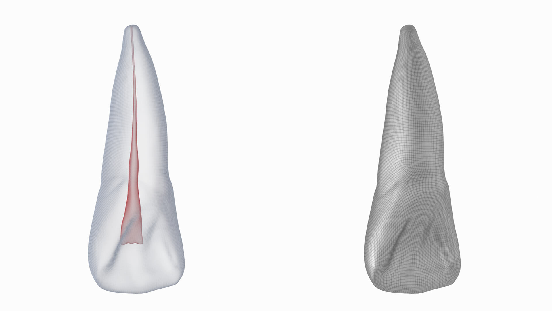 Human Upper Left Central Incisor Tooth With Pulp Cavity - 3D Model by ...