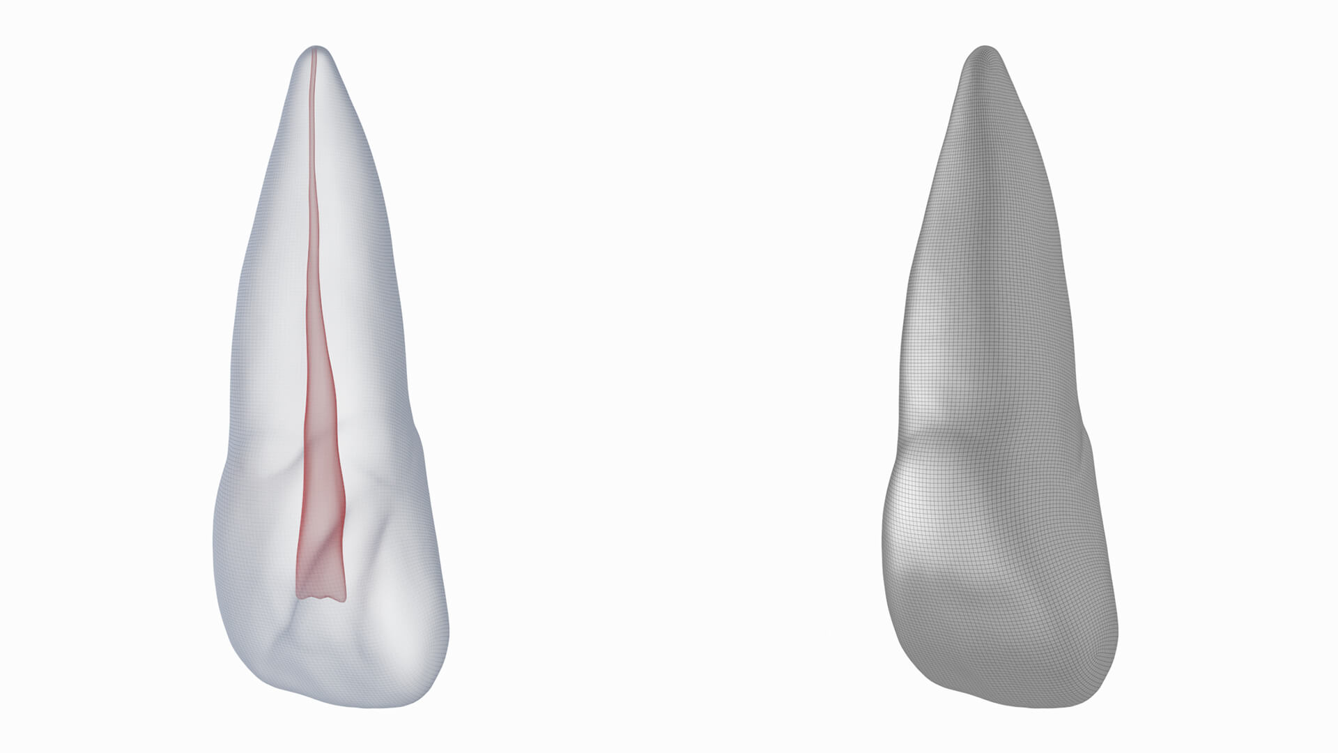 Human Upper Left Central Incisor Tooth With Pulp Cavity - 3D Model by ...
