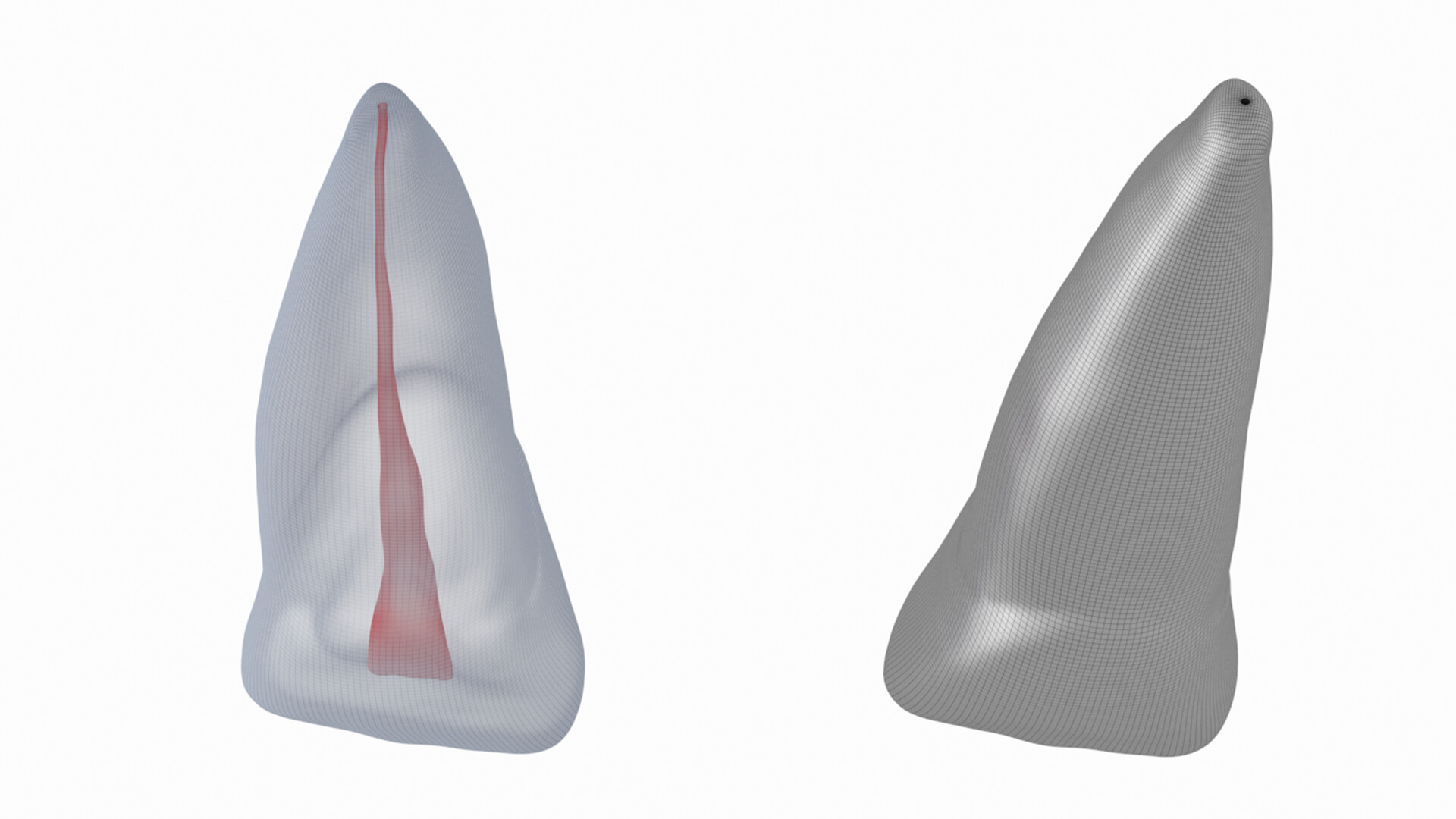 Human Upper Left Central Incisor Tooth With Pulp Cavity - 3D Model by ...