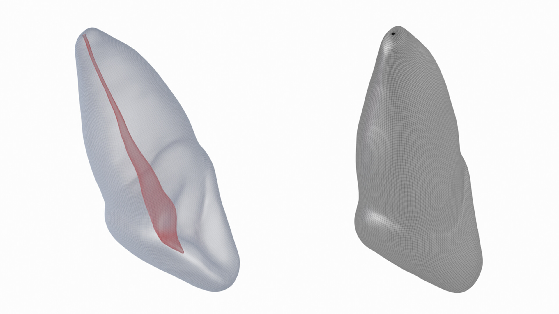 Human Upper Left Central Incisor Tooth With Pulp Cavity - 3D Model by ...