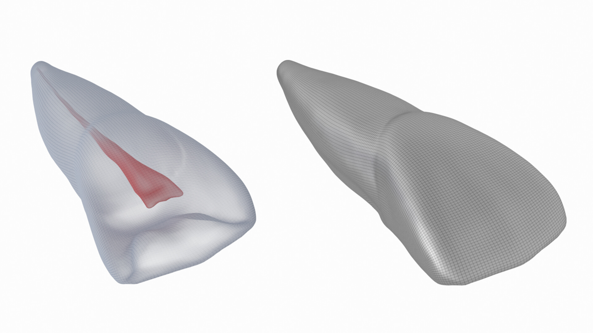 Human Upper Left Central Incisor Tooth With Pulp Cavity - 3D Model by ...
