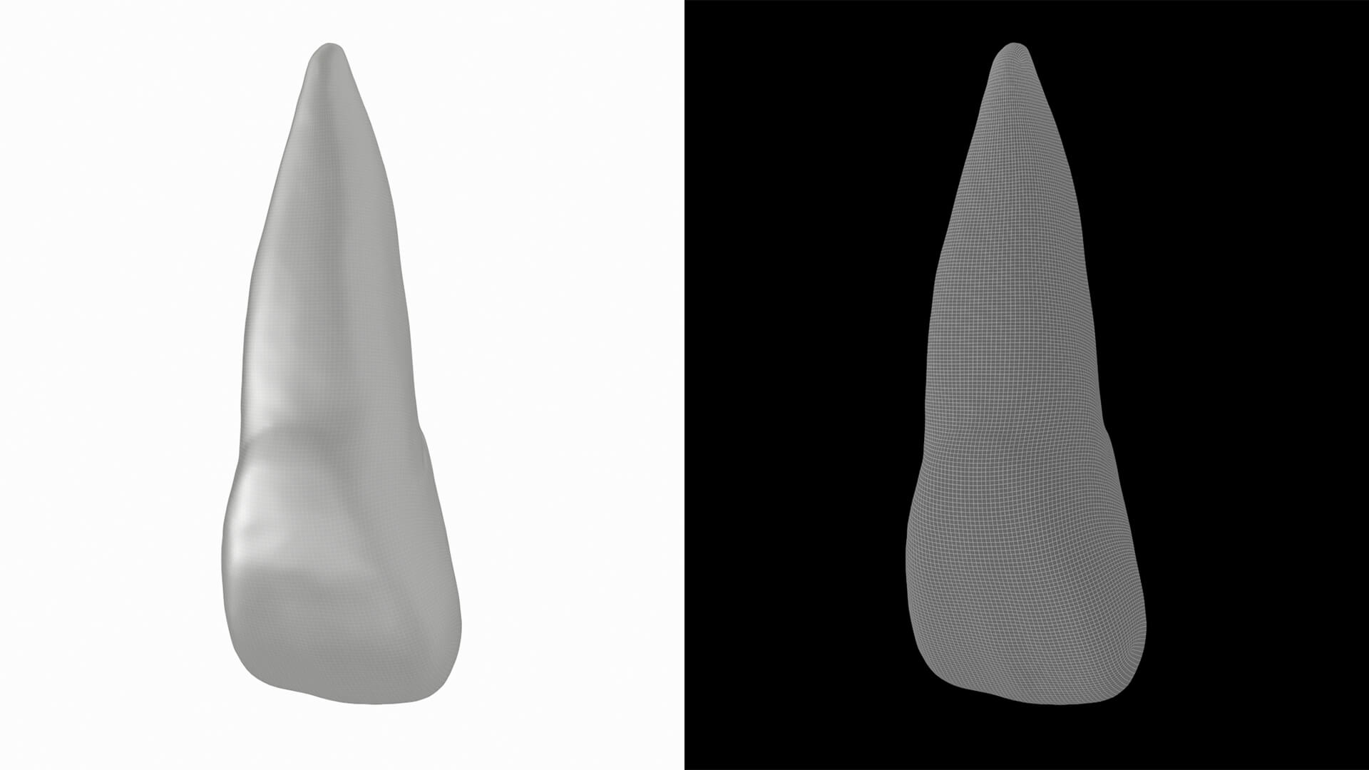 Human Upper Left Central Incisor Tooth - 3D Model by Valerii-Kaliuzhnyi