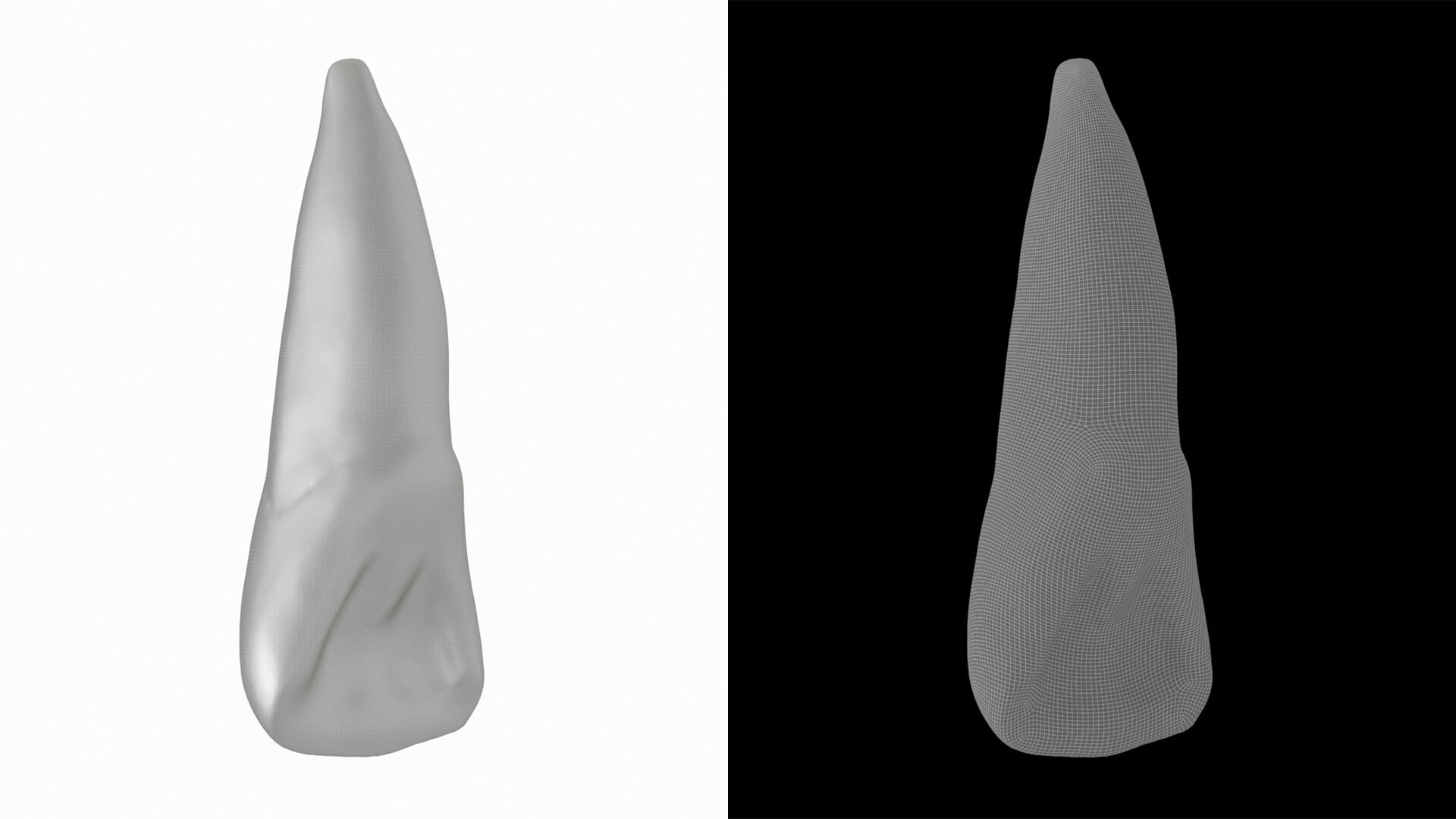 Human Upper Left Central Incisor Tooth - 3D Model by Valerii-Kaliuzhnyi