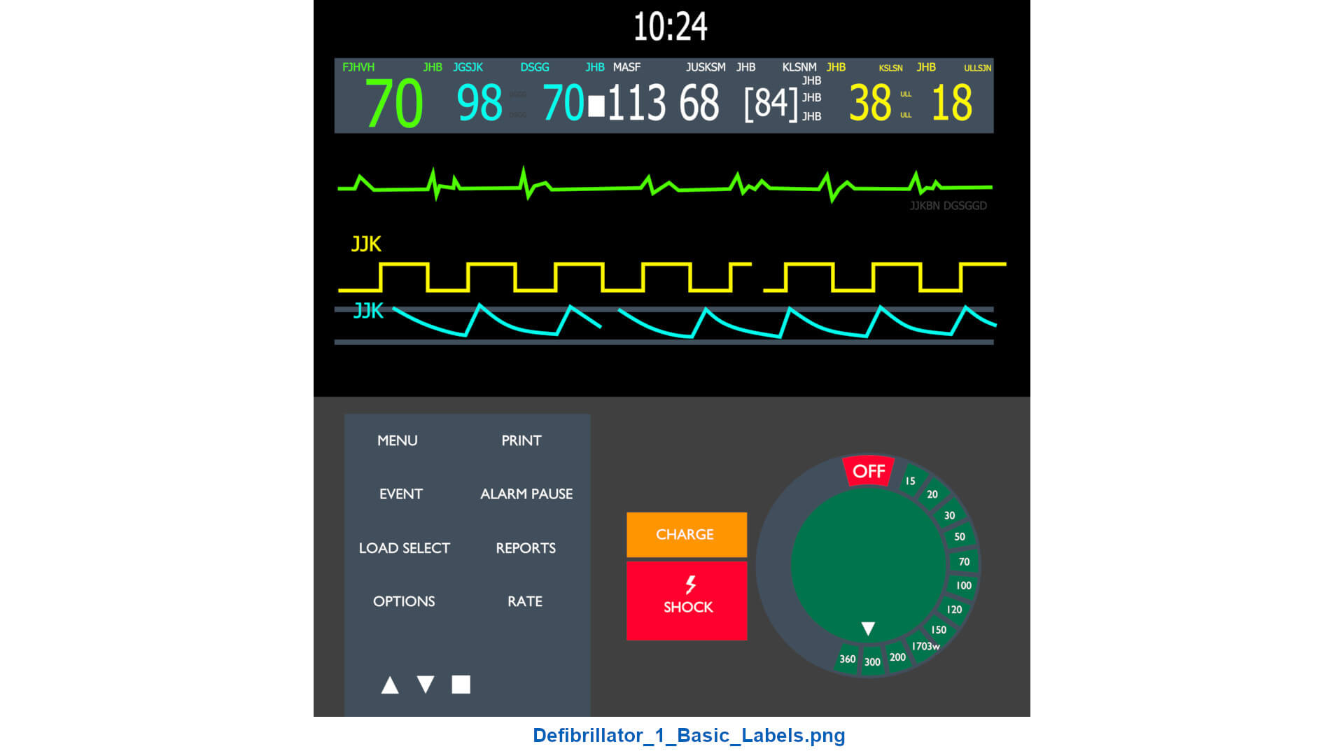 Defibrillator 1 Basic - 3D Model by weeray