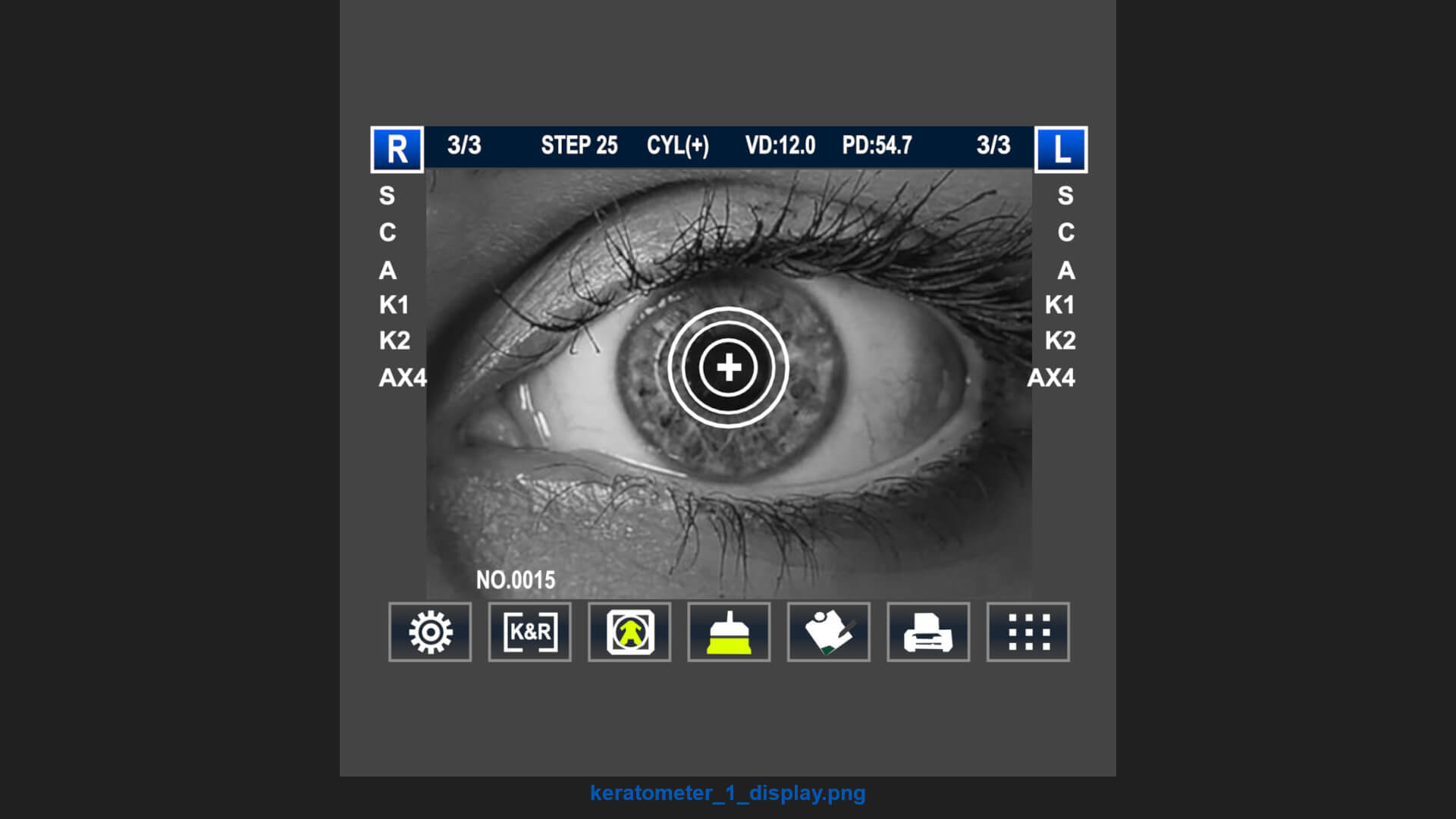 Keratometer 1 Basic - 3D Model by weeray