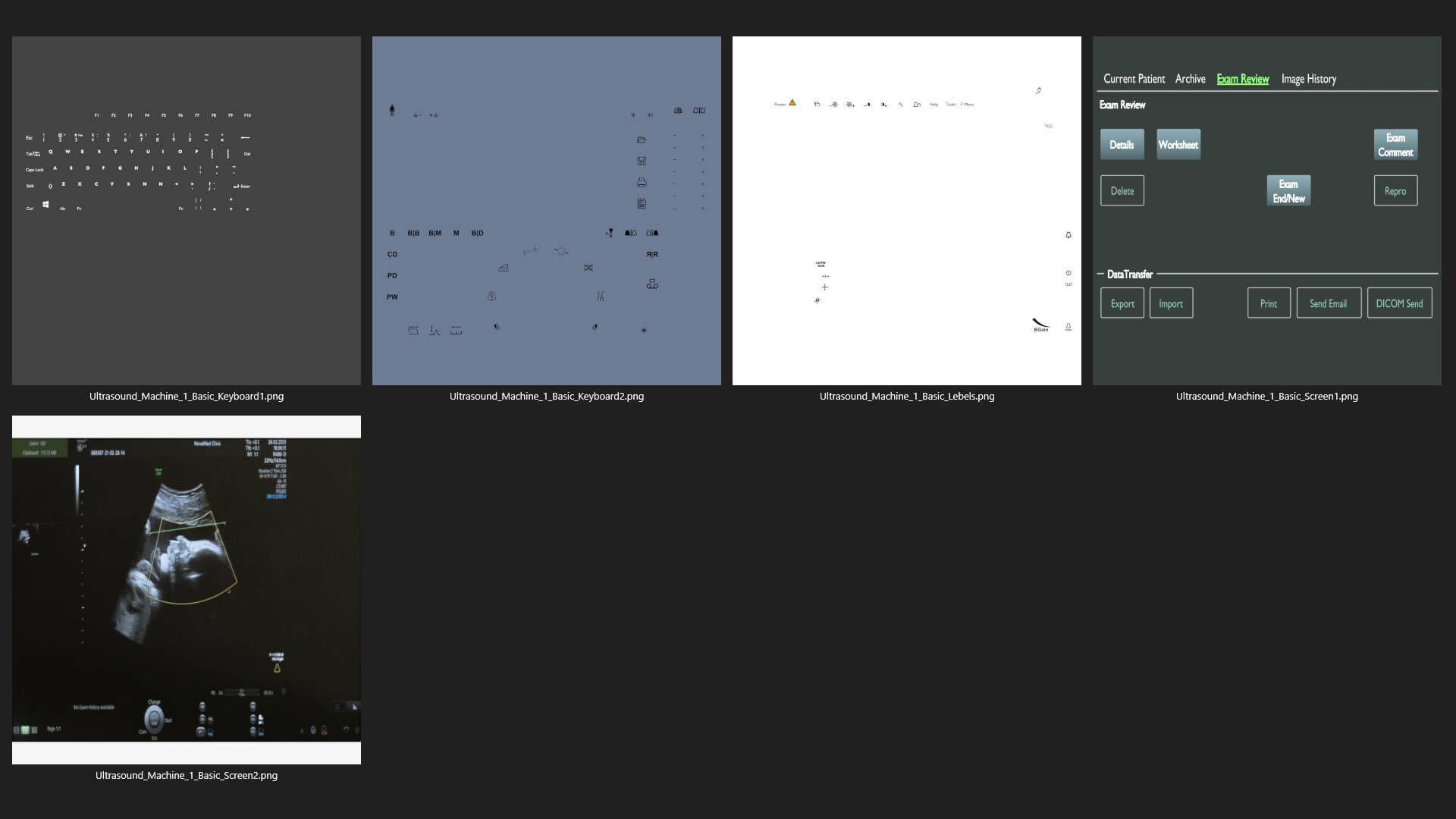 Ultrasound Machine 1 Basic - 3D Model by weeray