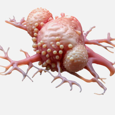 Cancer Cell Tumor - 3D Model by zames1992d