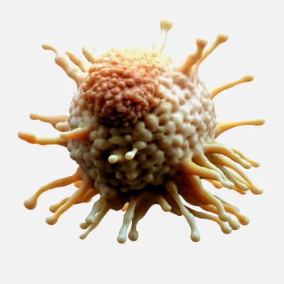 Cancer Cell Tumor - 3D Model by zames1992d