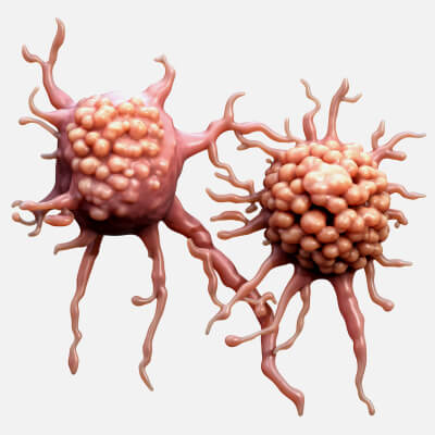 Cancer Cell Tumor - 3D Model by zames1992d