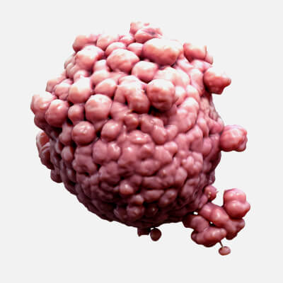 Cancer Cell Tumor - 3D Model by zames1992d