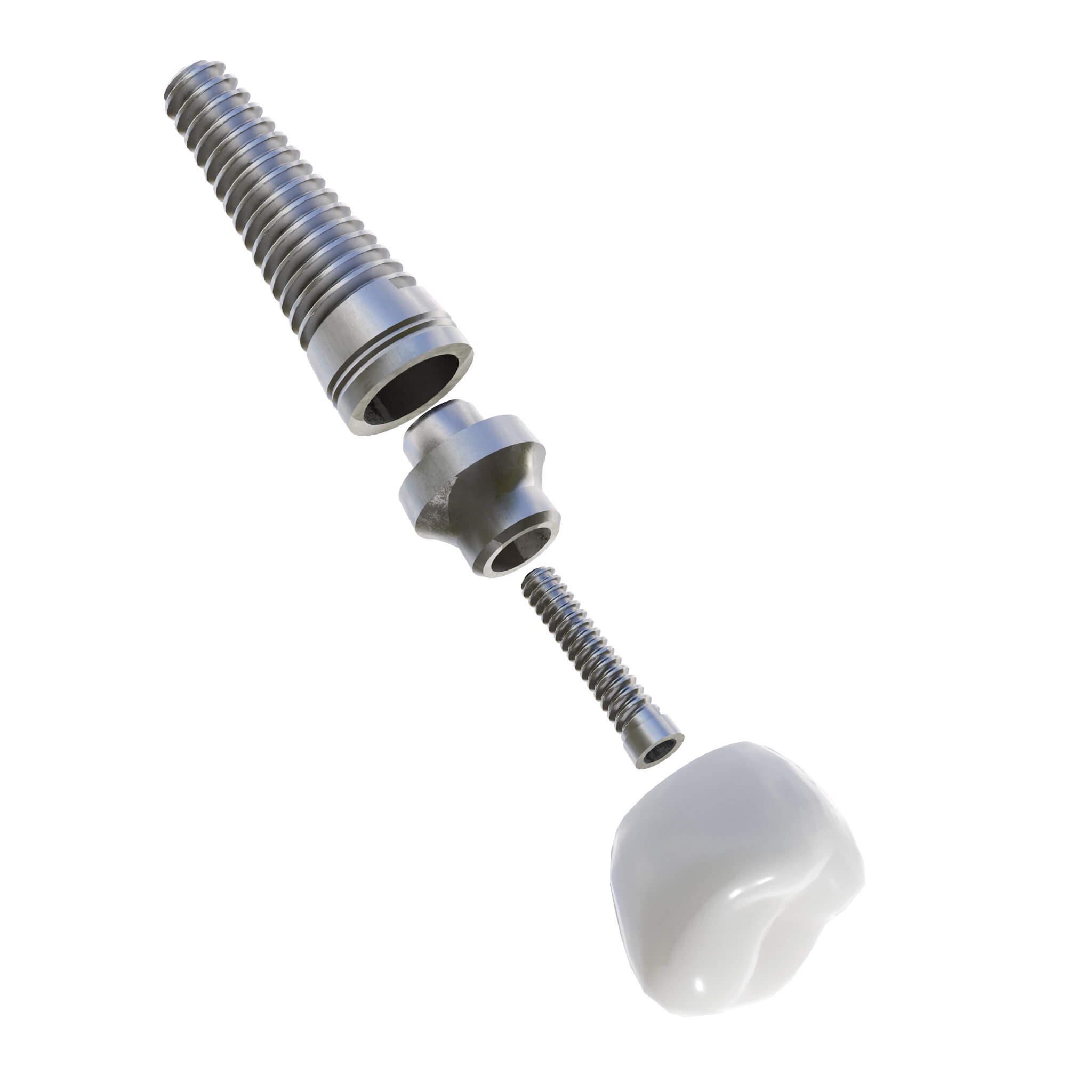 Dental Implant Animation - 3D Model by zames1992d