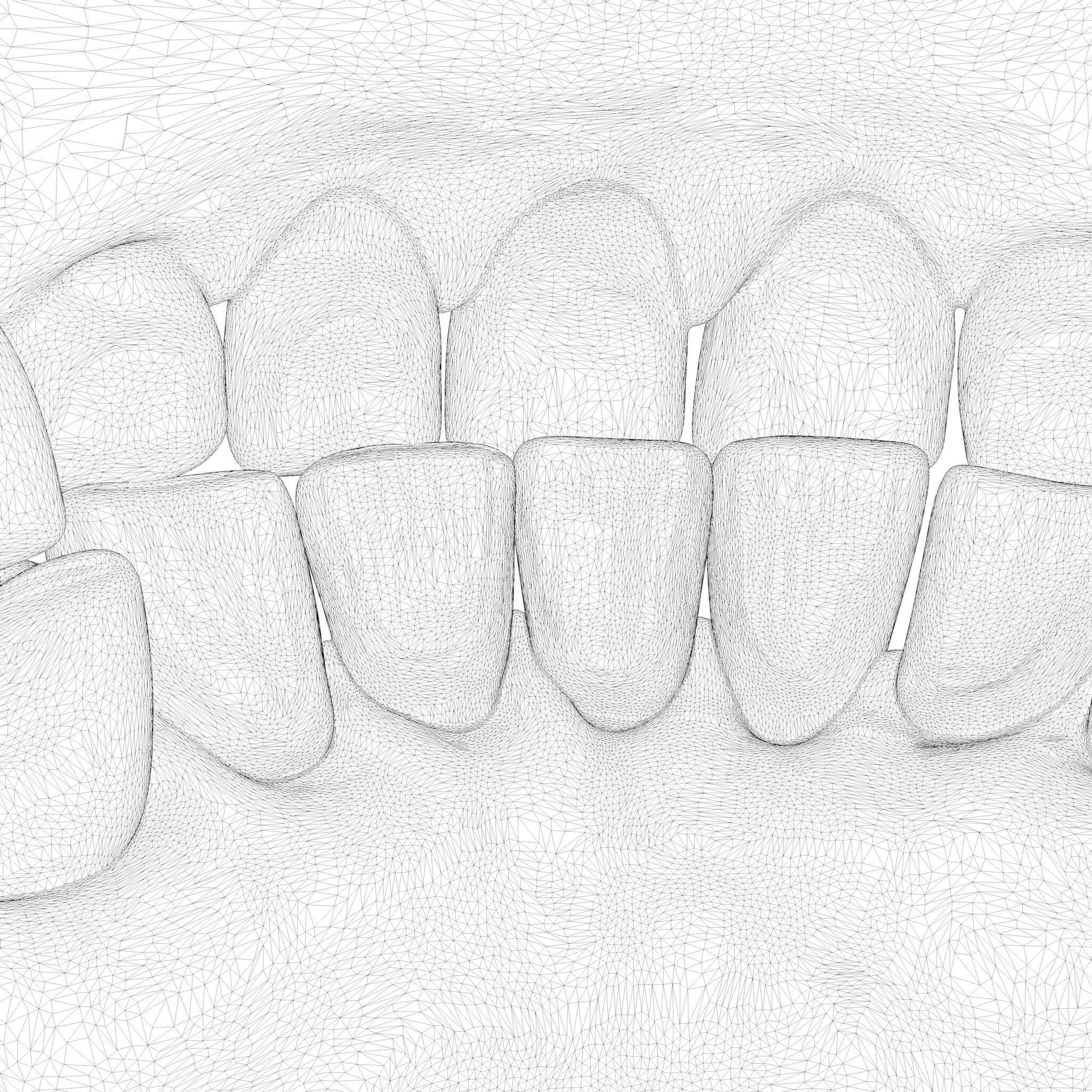 Dentures Mold - 3D Model by zames1992d