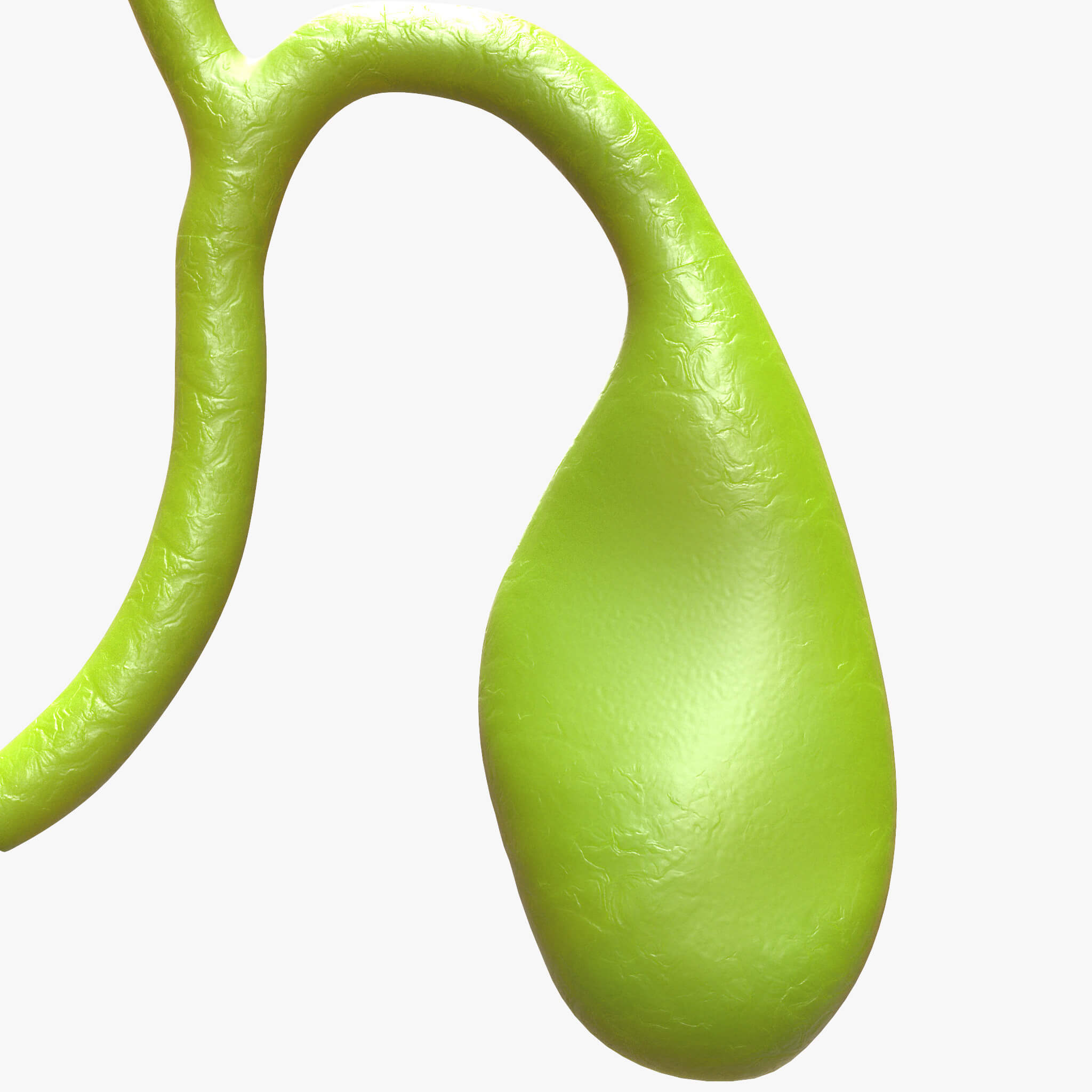 Gallbladder With Gallstones - 3D Model by zames1992d