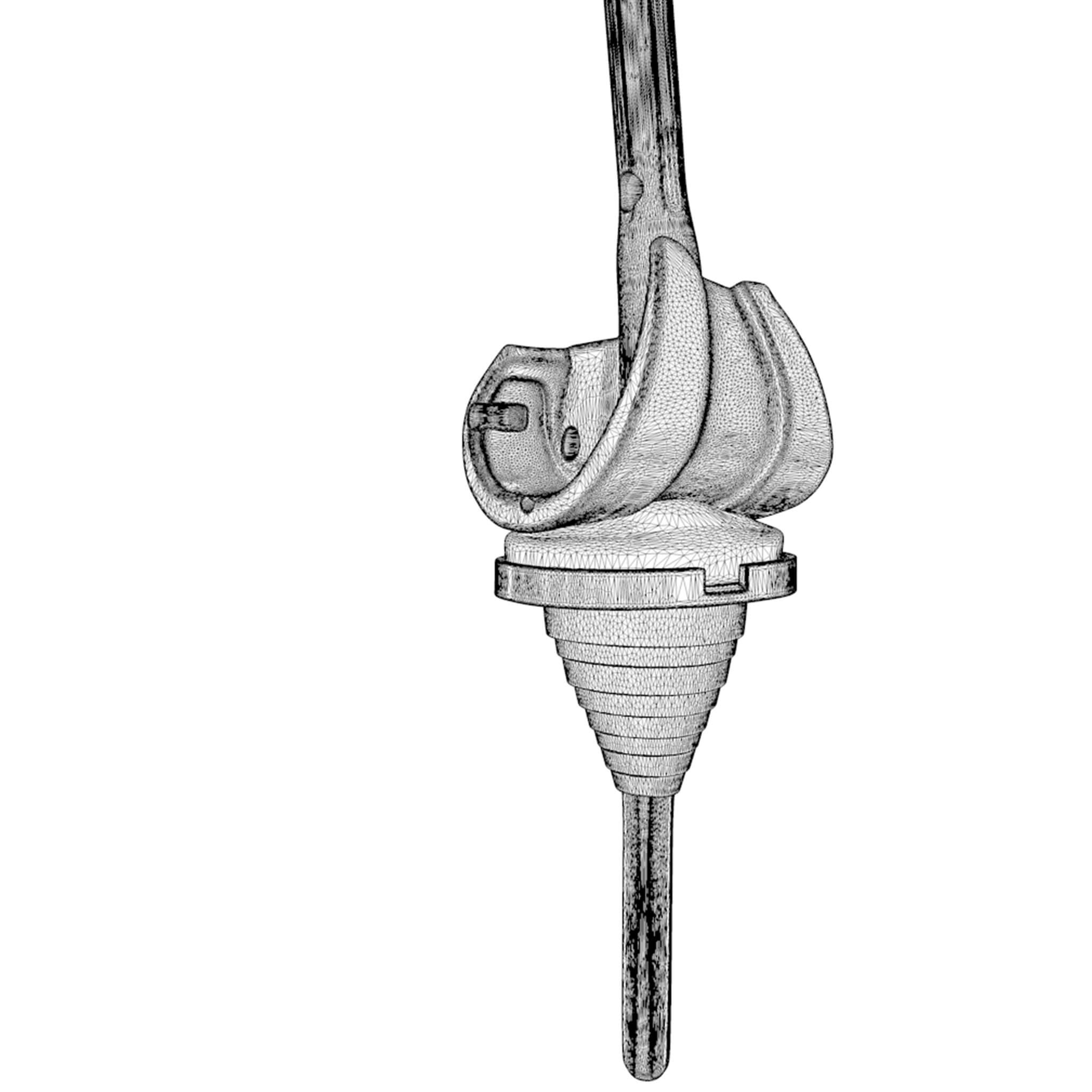 Knee Replacement Implant - 3D Model by zames1992d